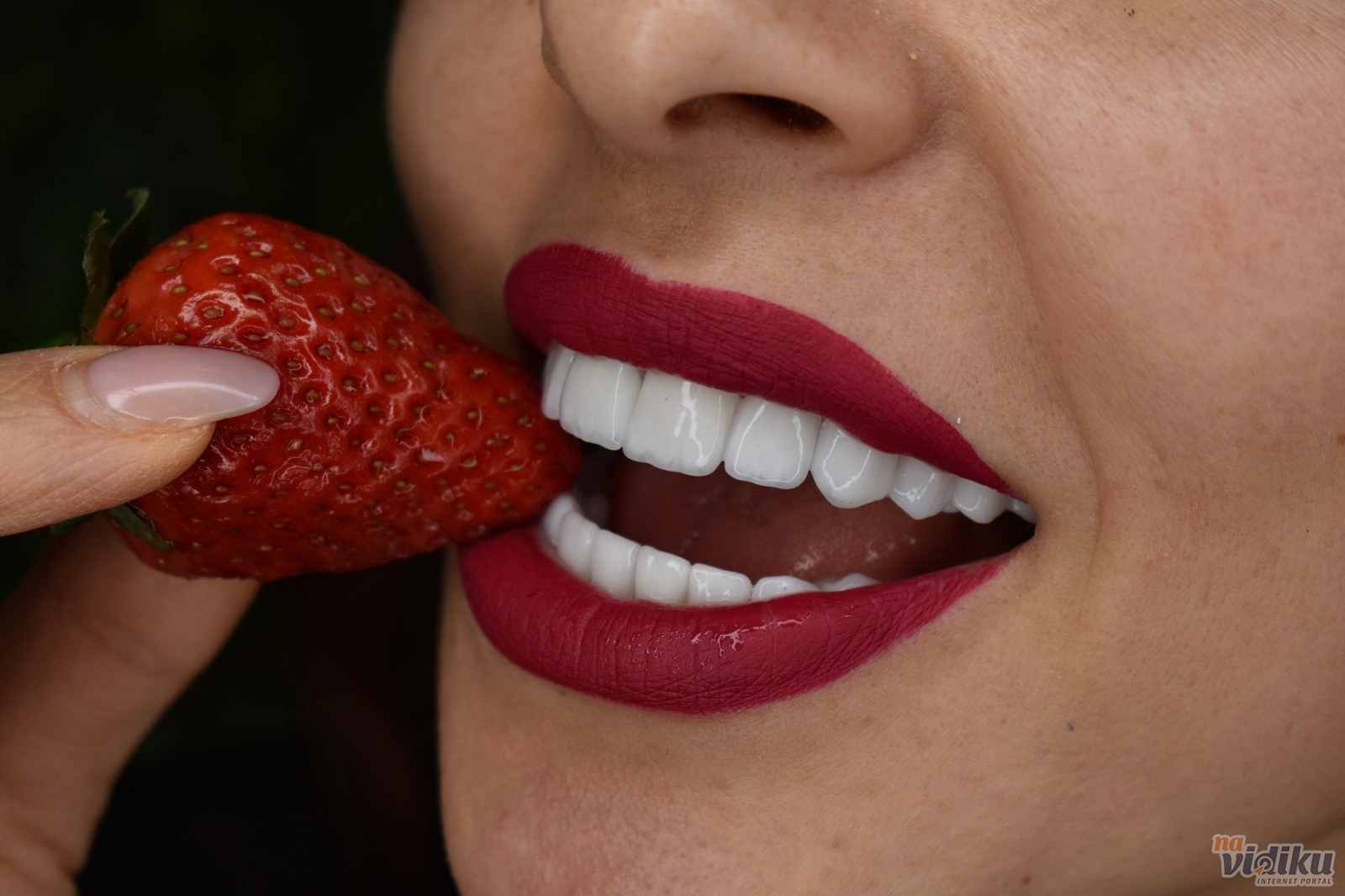 Bezmetalne i metalne krunice, Dental Aesthetica slike