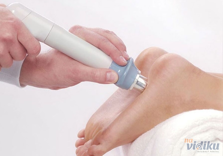 Shockwave medicinska terapija: teniski lakat, smrznuto rame, petni trn ...