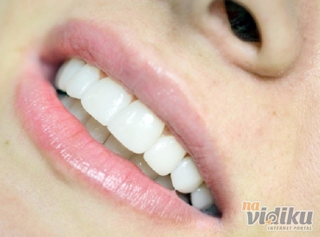 Implant Neodent 7+1 GRATIS! - Apostoloski Dental Centar stomatološka ...