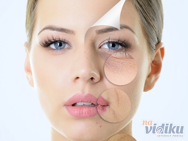 Botox čela i regije oko očiju - Kozmeticki Salon Impressio - akcije ...