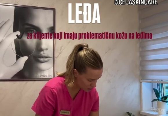 HIGIJENSKI TRETMAN LEĐA - Ceca Skin Care, Novi Sad